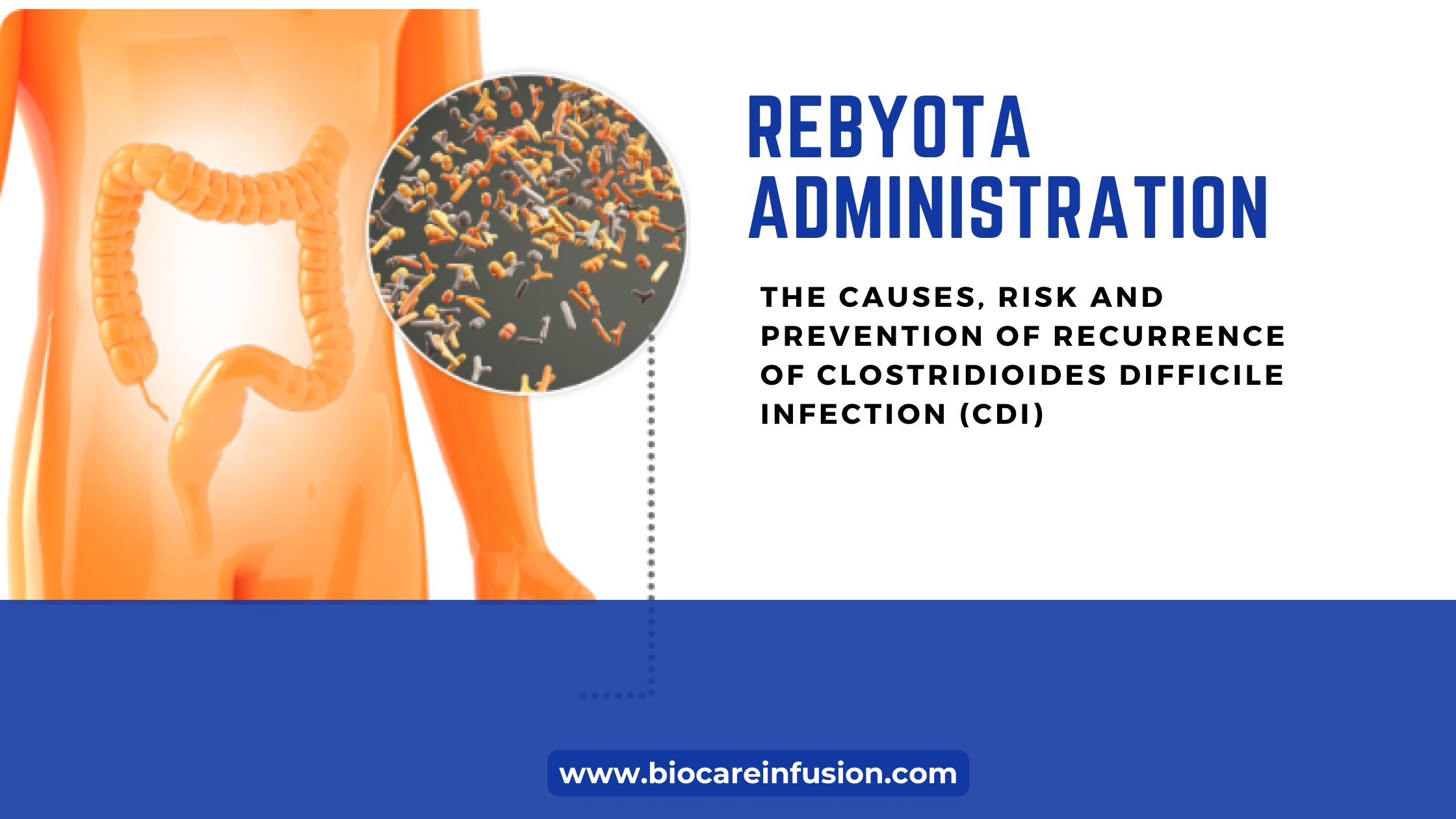 Rebyota Administration - Biocare Oncology & Therapeutics